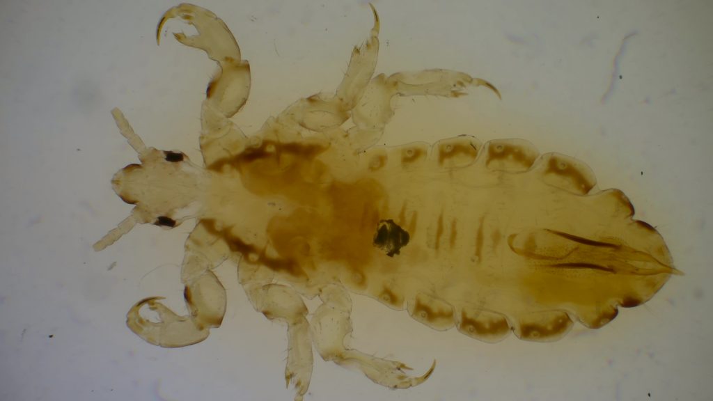 BMH Social Responsibility | The Gibson Microscope Slide Collection ...