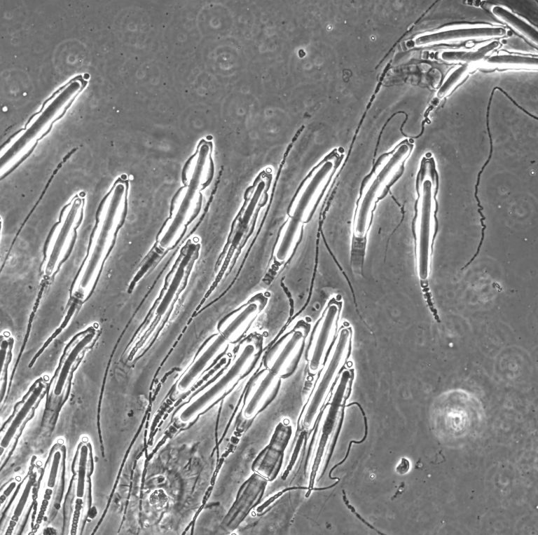 Invertebrates Examples